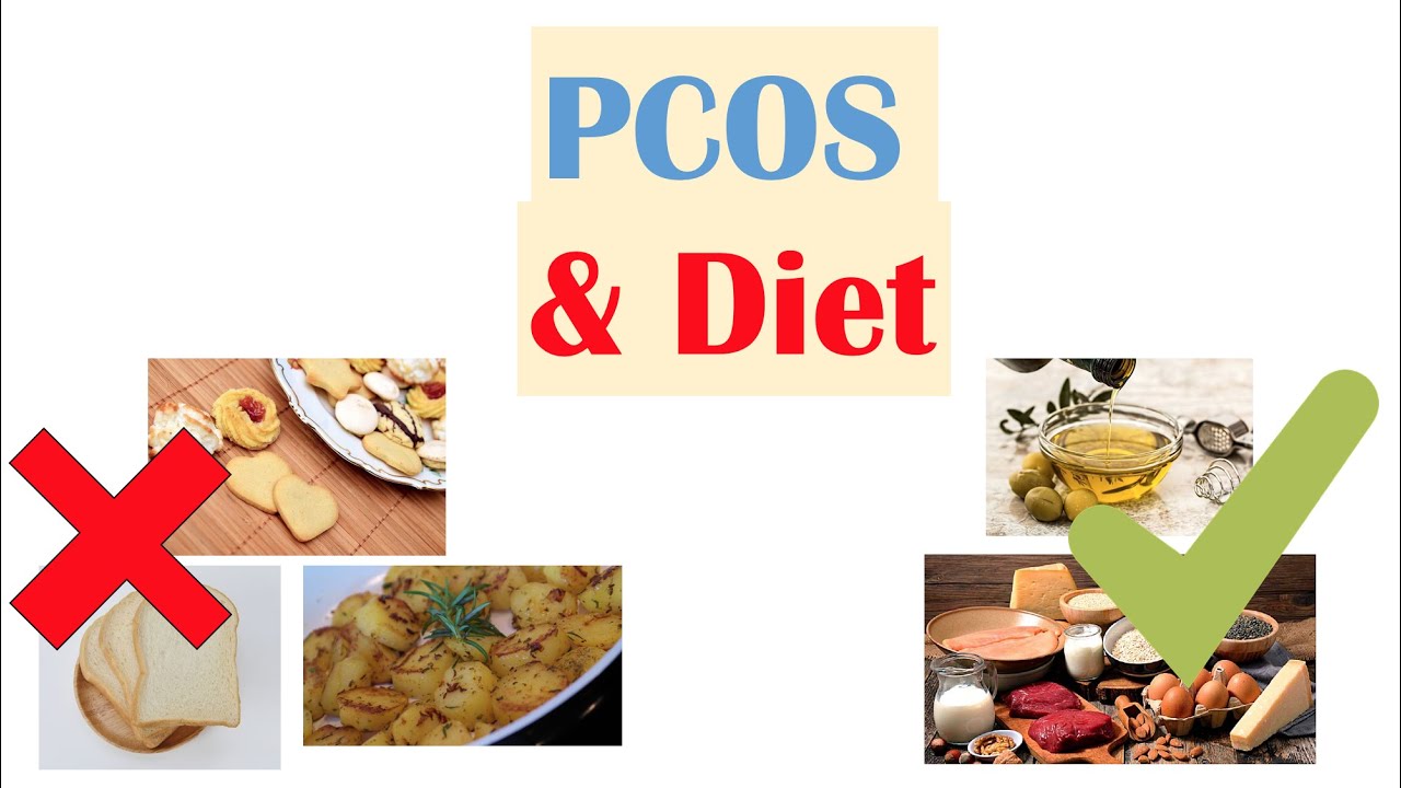 Polycystic Ovary Syndrome (PCOS) & Diet | Mediterranean vs. Ketogenic ...